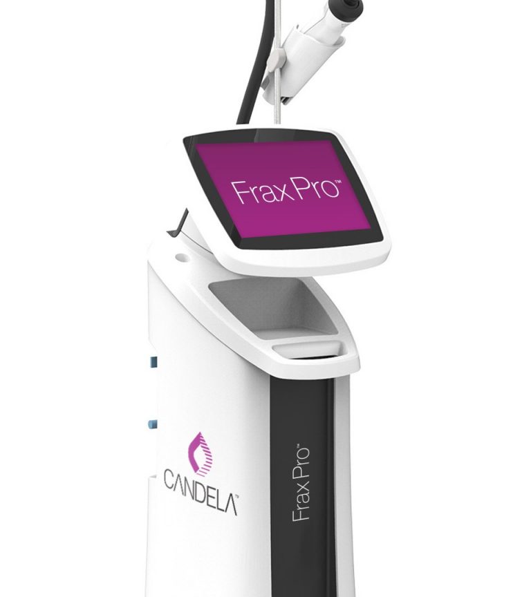 Female Daily Editorial - Frax Pro, Treatment Laser Terbaru untuk ...